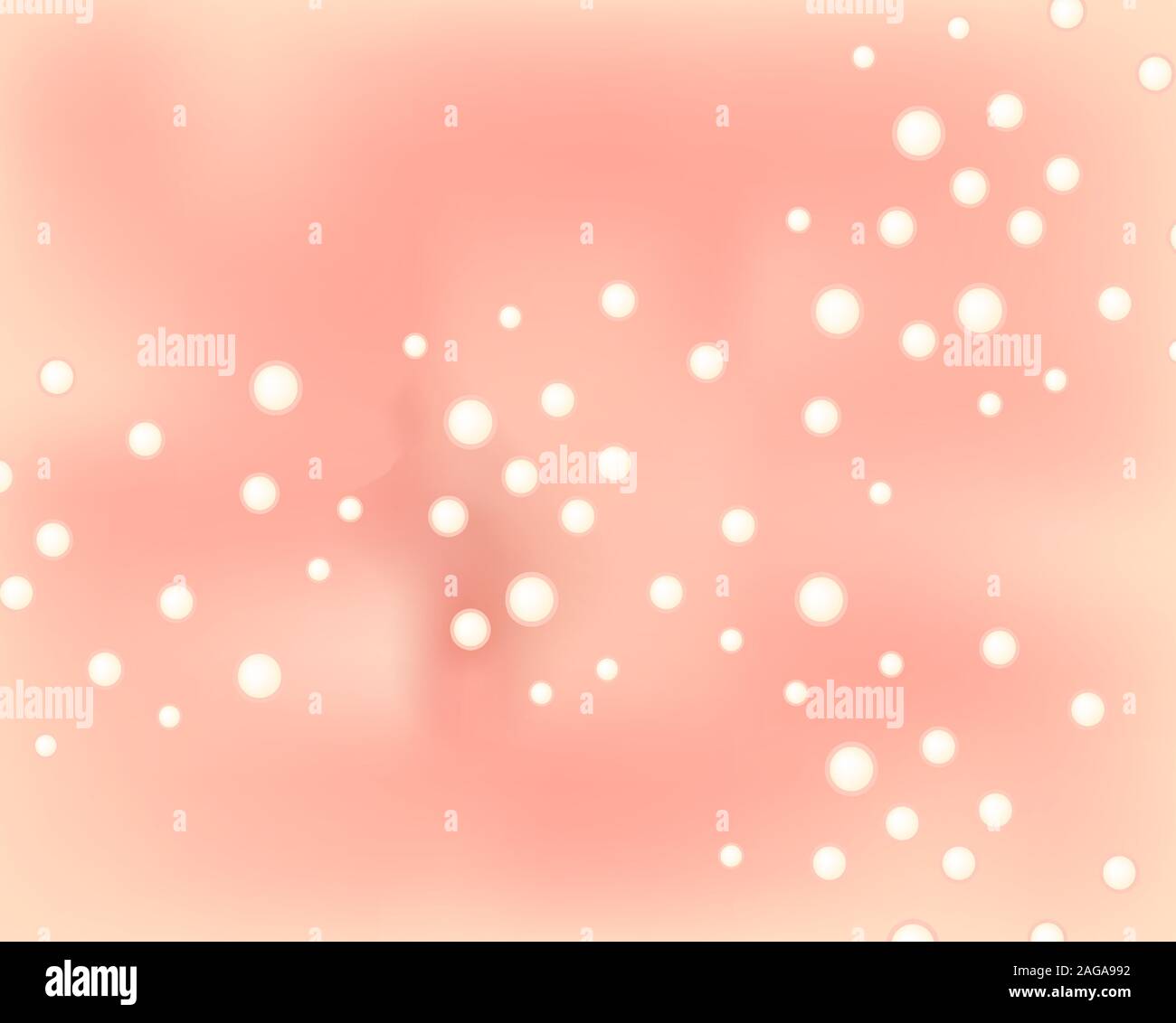 Miliums, appelés comédons fermés, la peau avec l'acné arrière-plan. Des ...