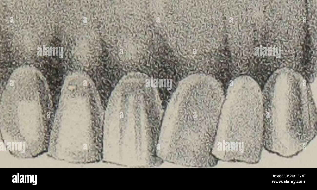 Central incisors human Banque de photographies et d’images à haute ...