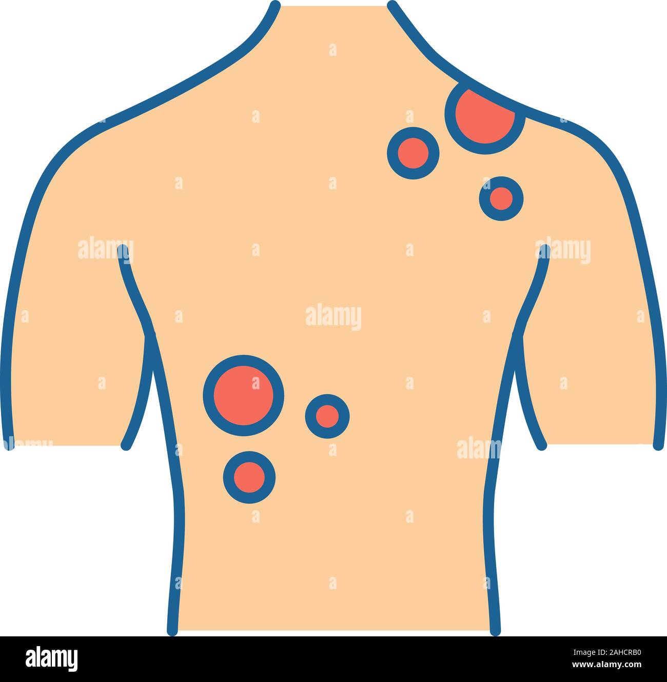 L'icône couleur du cancer de la peau. Les maladies dermatologiques ...