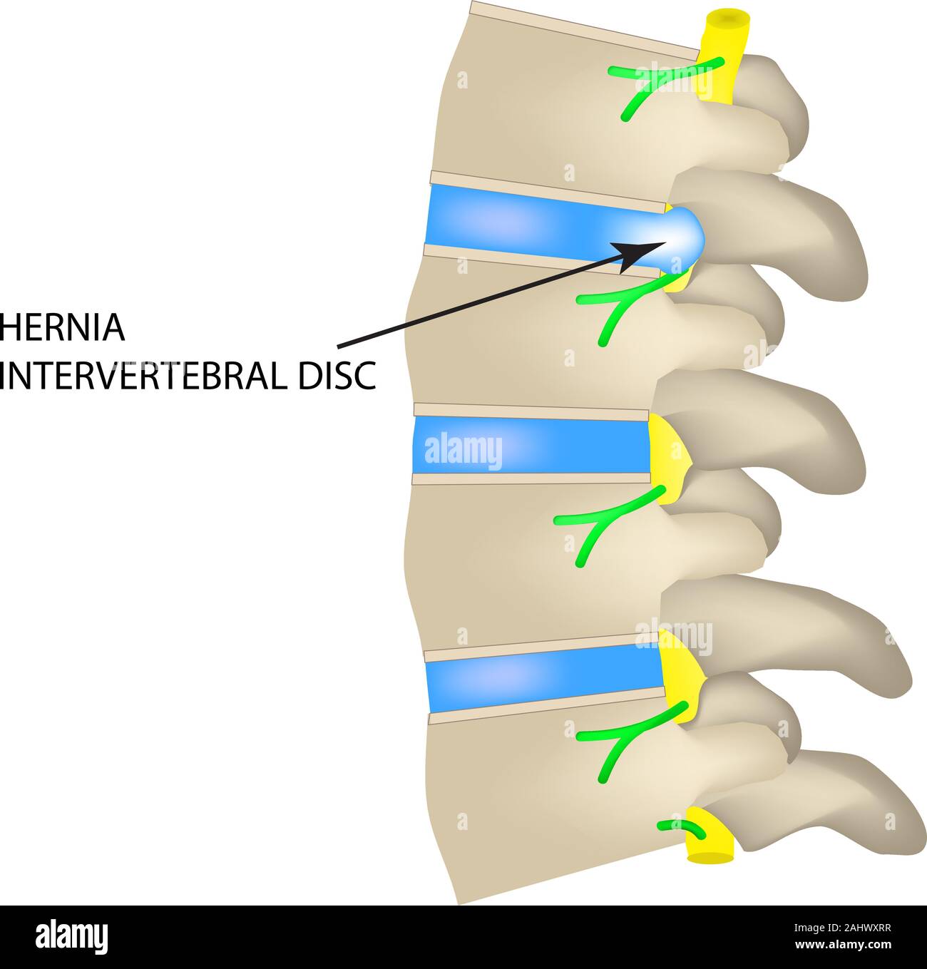 Intervertebral foramen Banque d'images vectorielles - Alamy