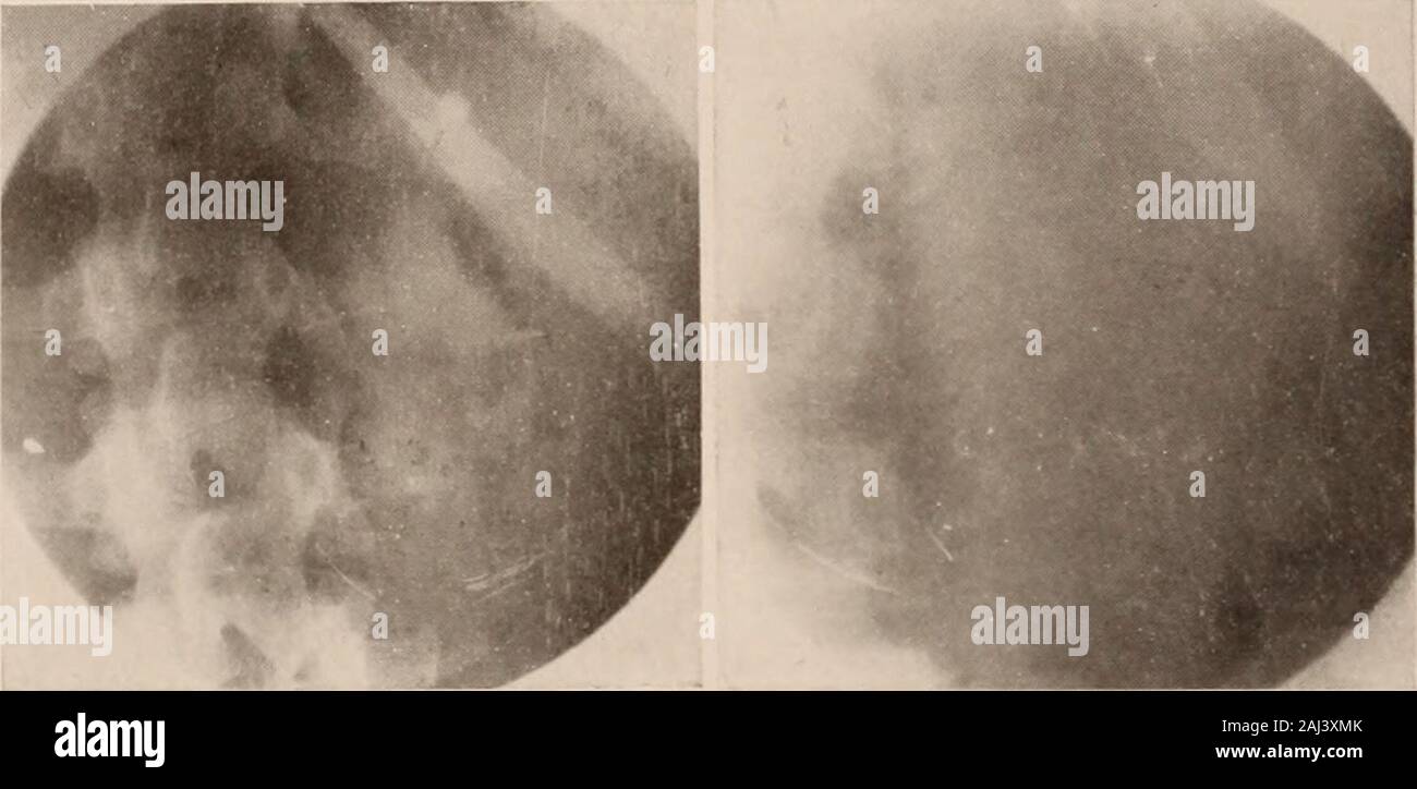 Colonne rénale Banque de photographies et d’images à haute résolution ...