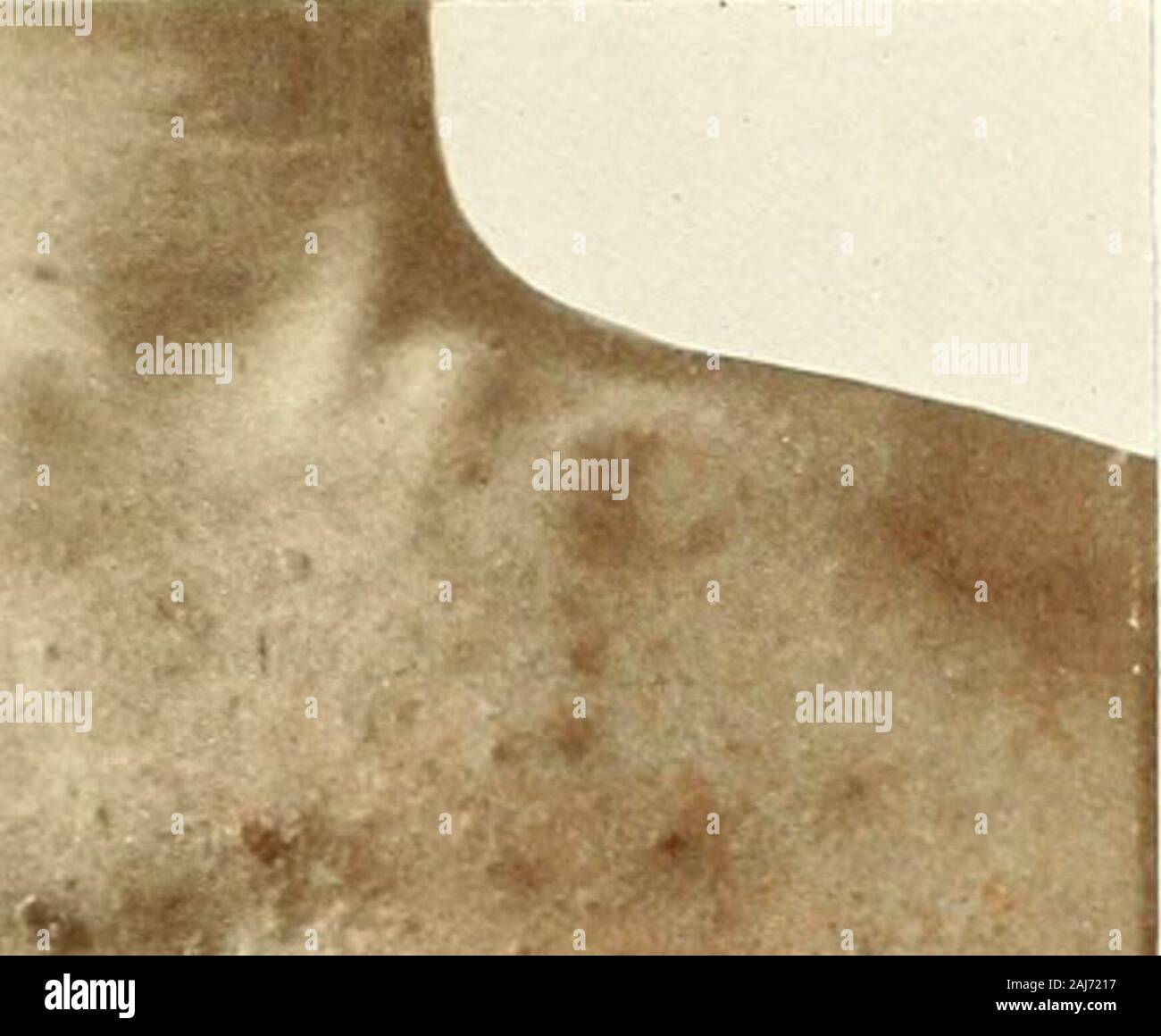 Atlas Photographique de la maladies de la peau ; une série de quatre ...