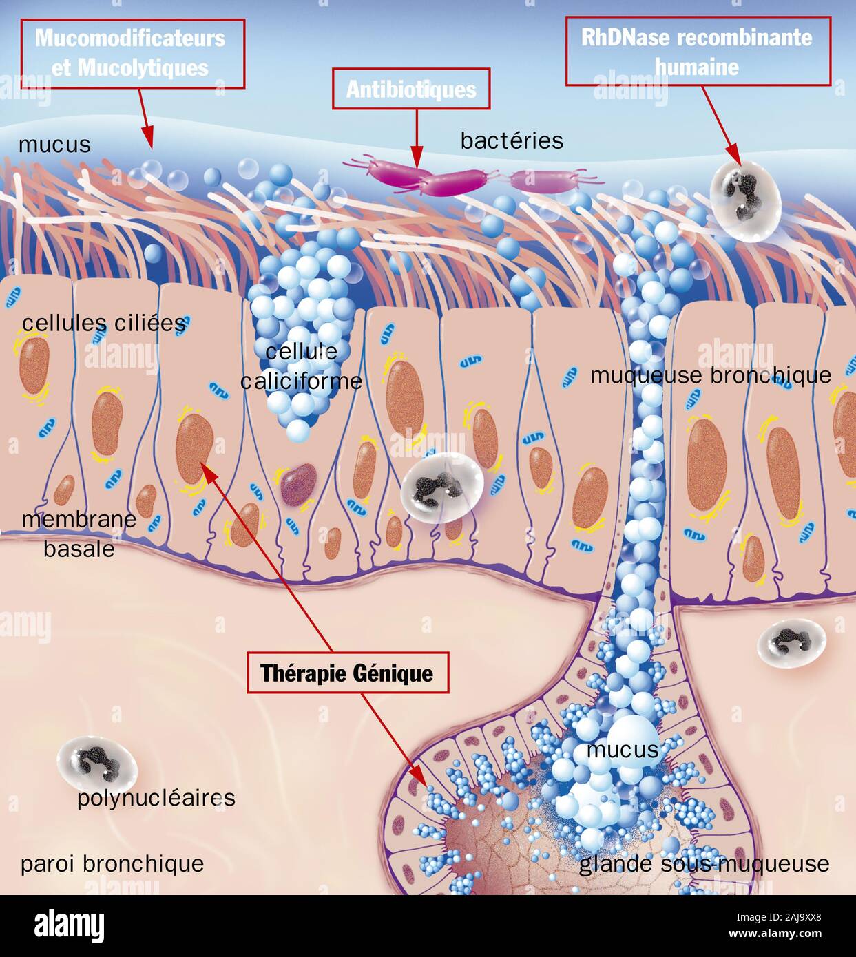 Pathologies respiratoires Banque de photographies et d’images à haute ...