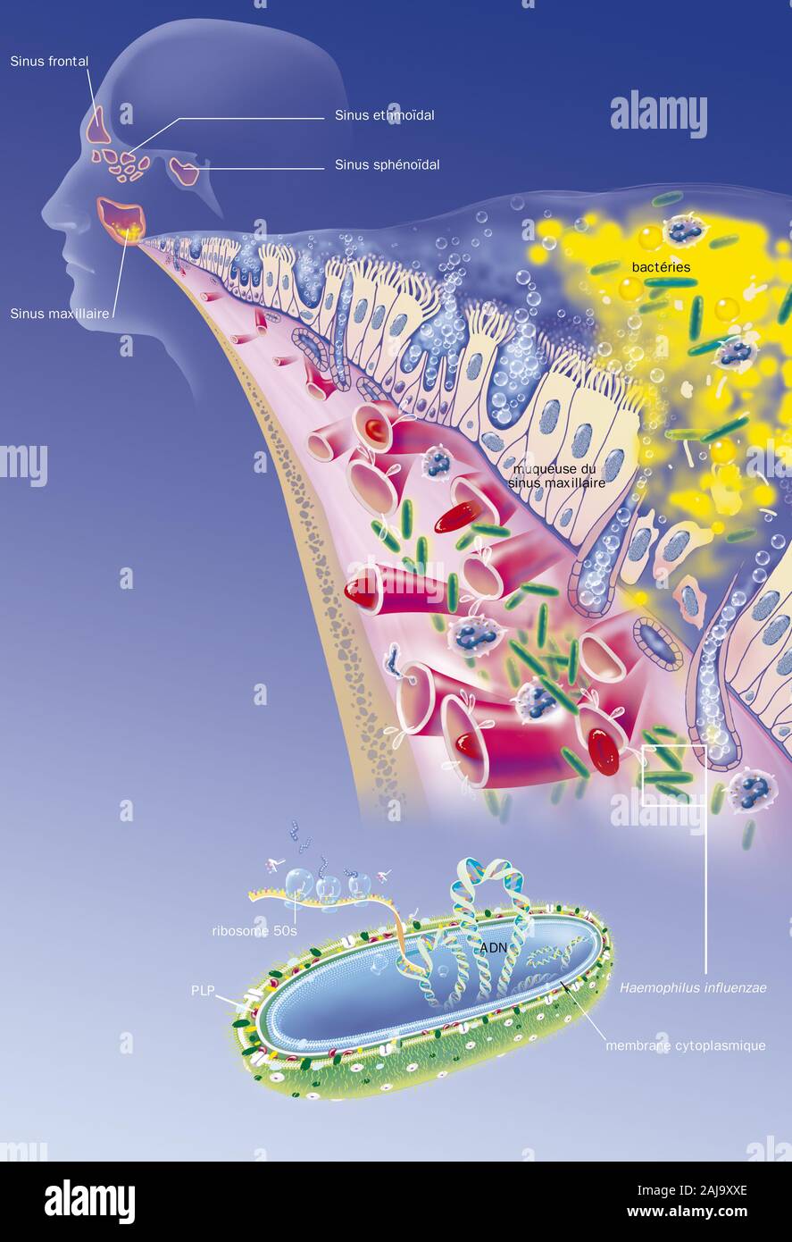Sinusite bactérienne Banque de photographies et d’images à haute ...