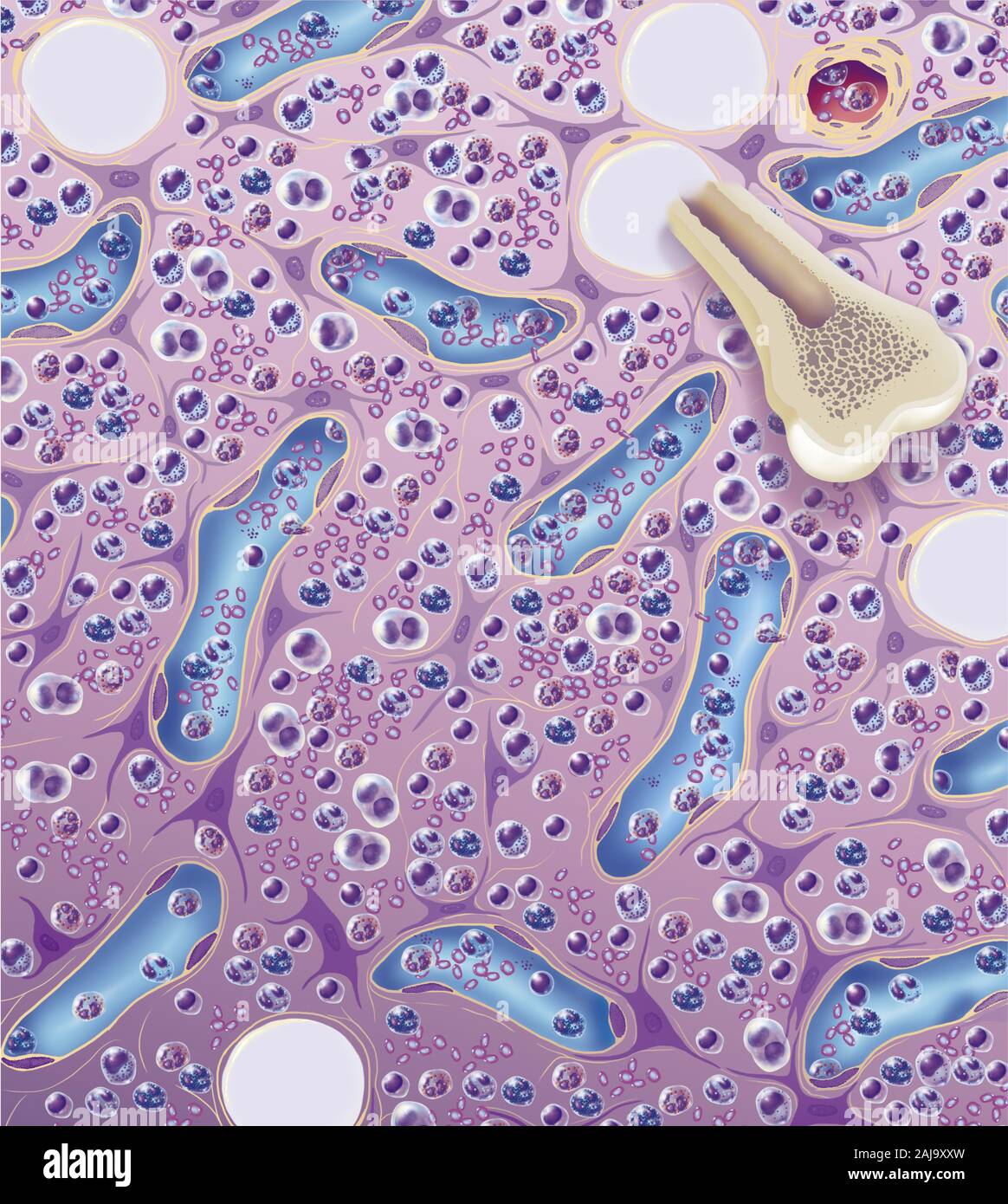 Leucémie myéloïde chronique Banque de photographies et d’images à haute ...