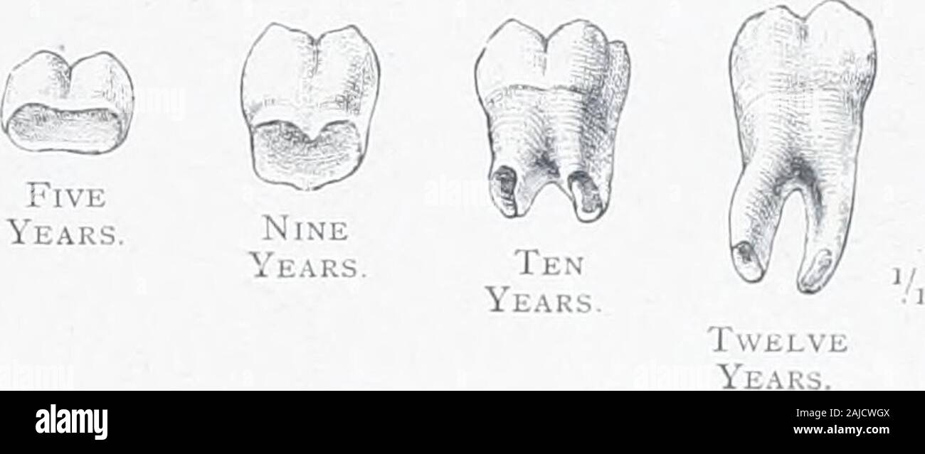 Première molaire du haut Banque d'images détourées - Alamy