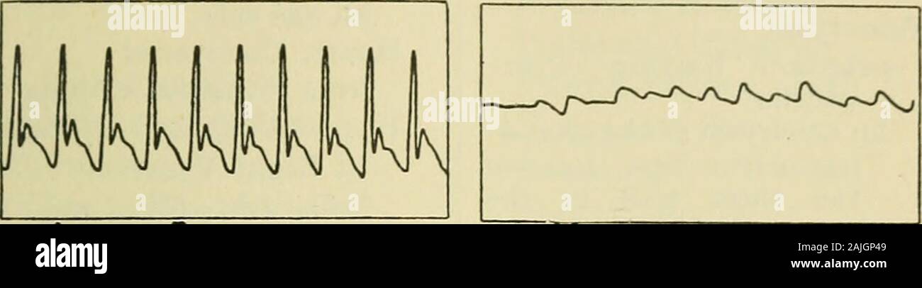 Un index des symptômes avec les méthodes de diagnostic . Pouls normal ...