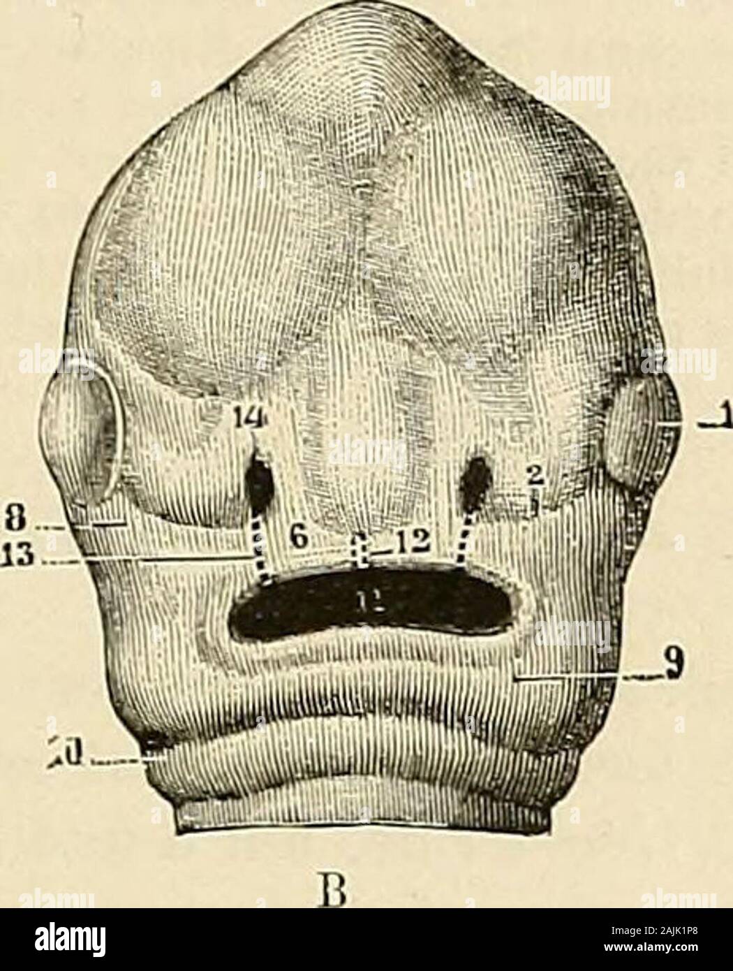 Traité d'anatomie humaine : Anatomie, histologie, développement ...