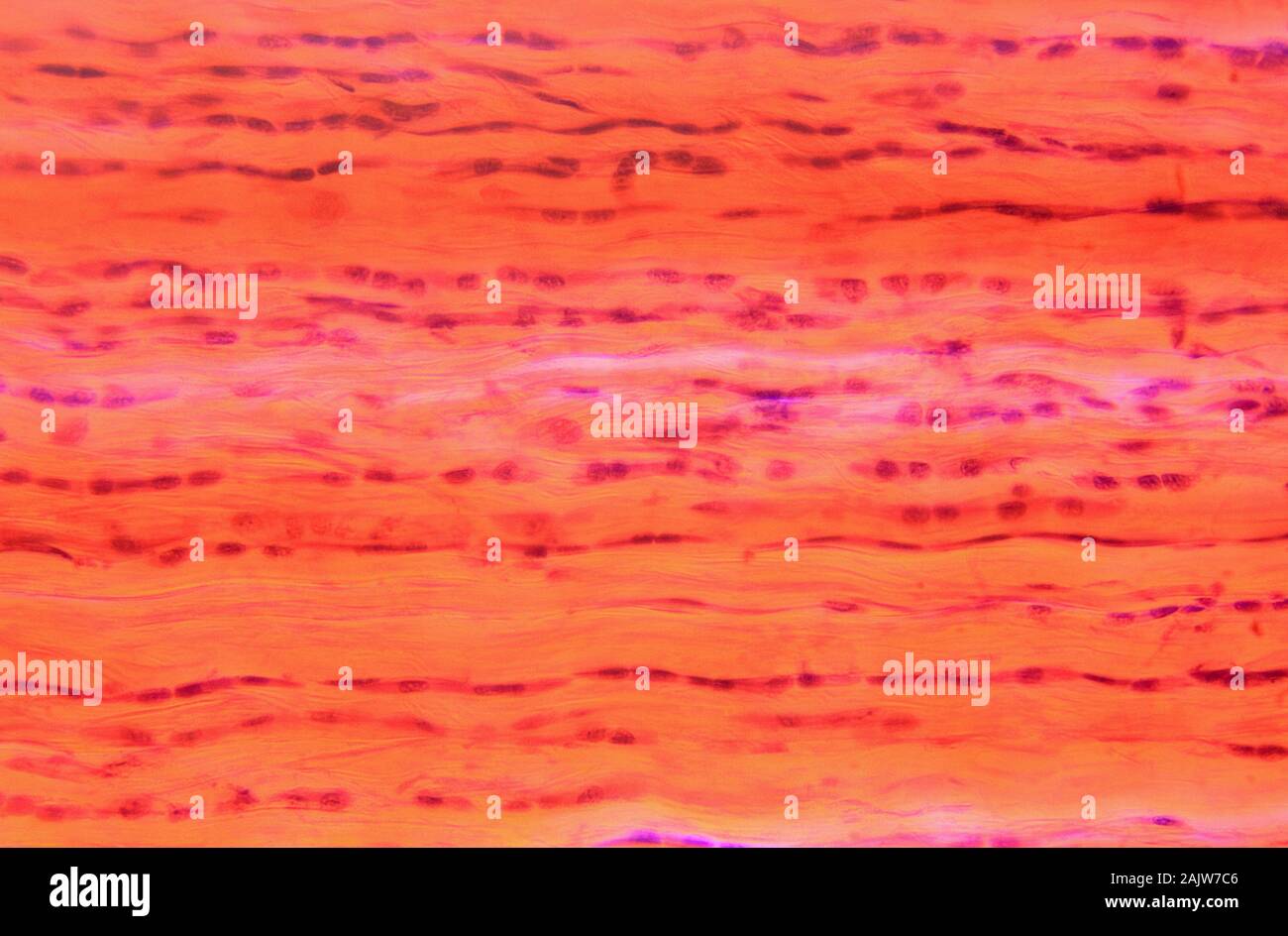 Tissue of the tendon Banque de photographies et d’images à haute ...