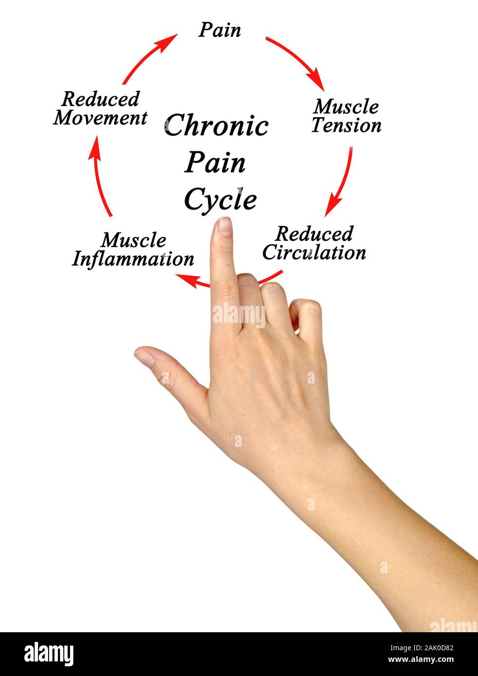 Étapes dans le cycle de la douleur chronique Photo Stock - Alamy