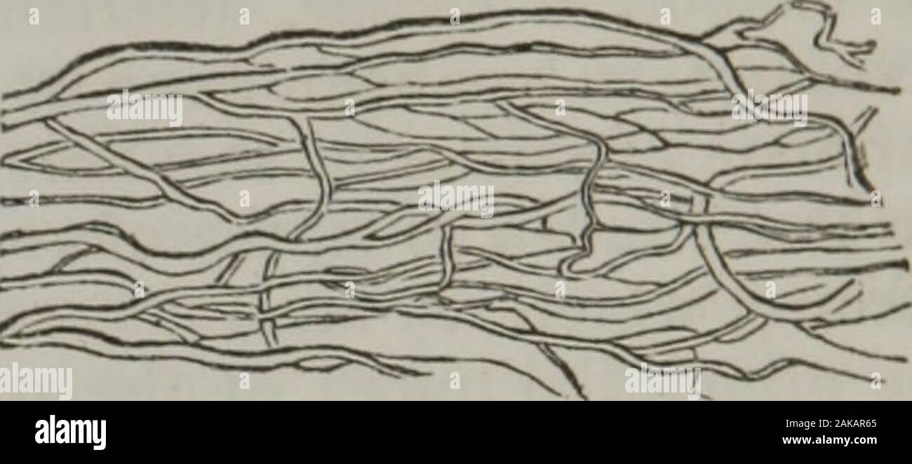 Éléments d'anatomie pathologique . ? L'arrangement des vaisseaux ...