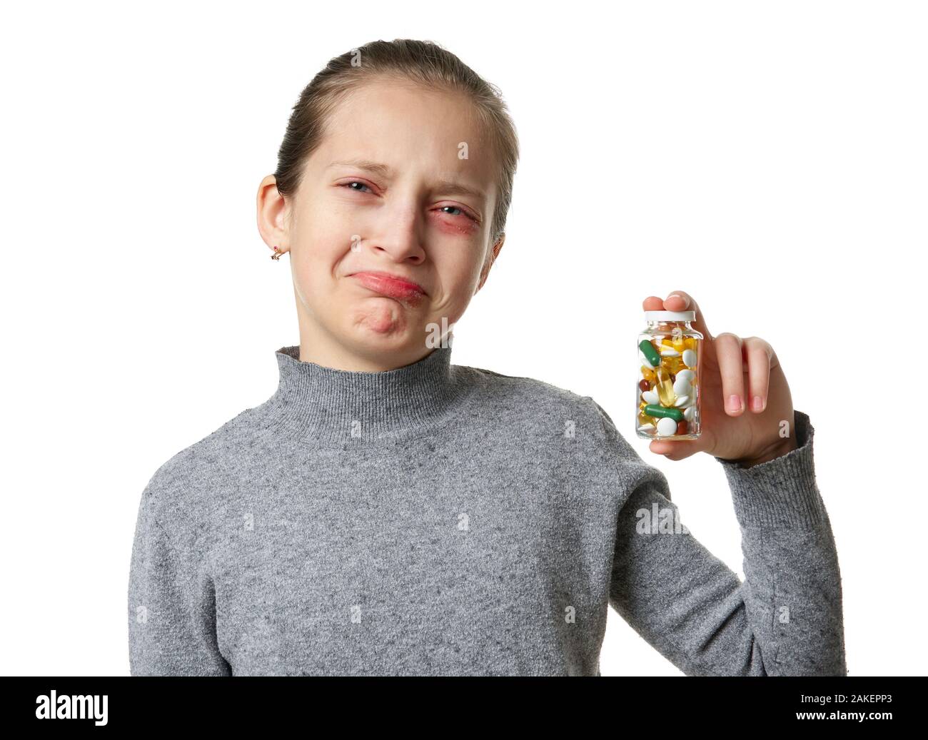 Réaction allergique, éruption de peau, fermer la vue portrait d'un ...