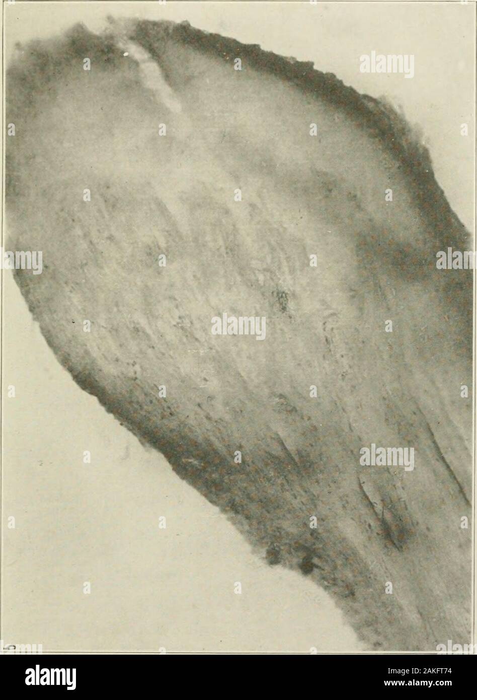 Pathologie dentaire général et, en particulier, sur l'étiologie et de l ...