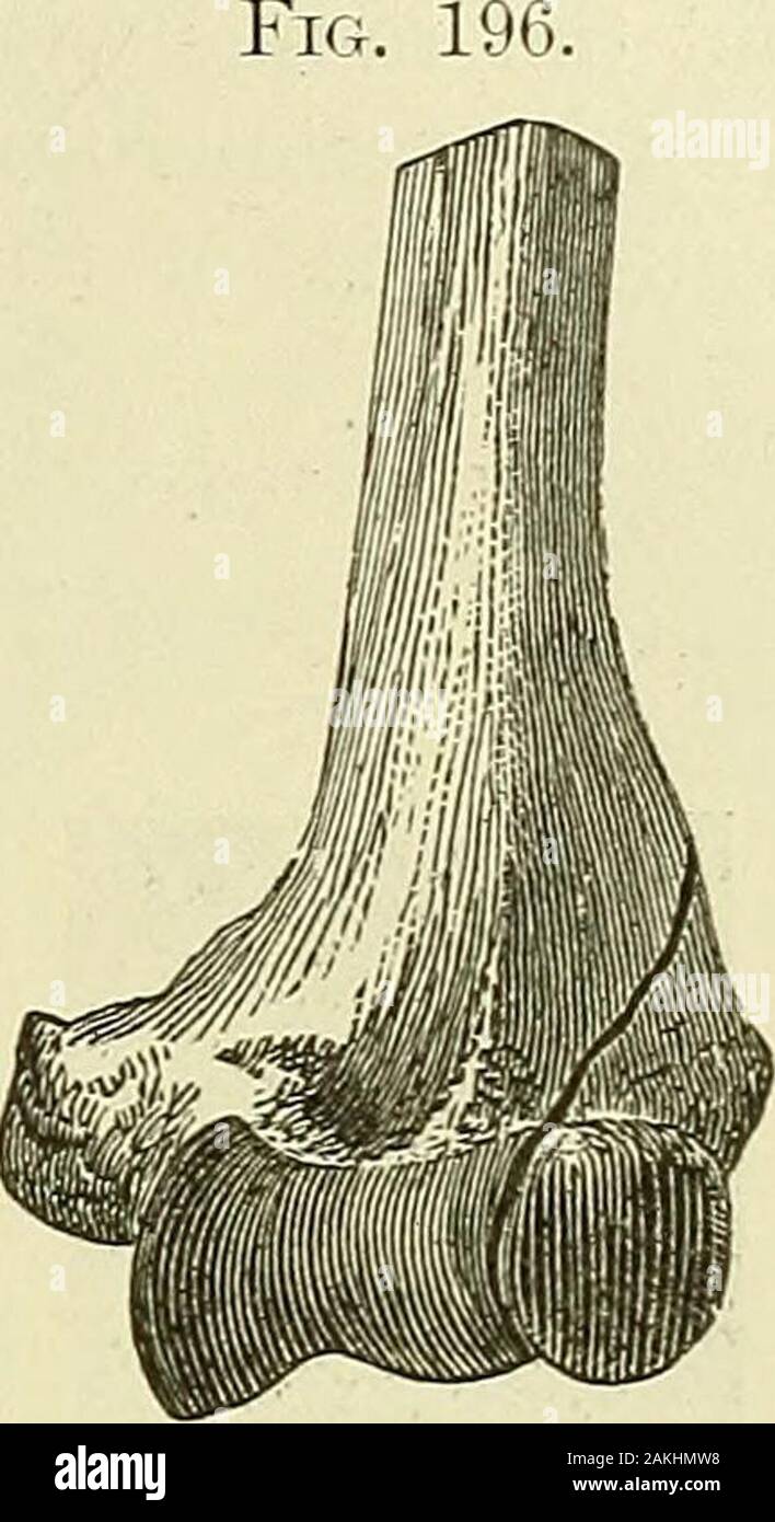 Condyle interne Banque de photographies et d’images à haute résolution ...
