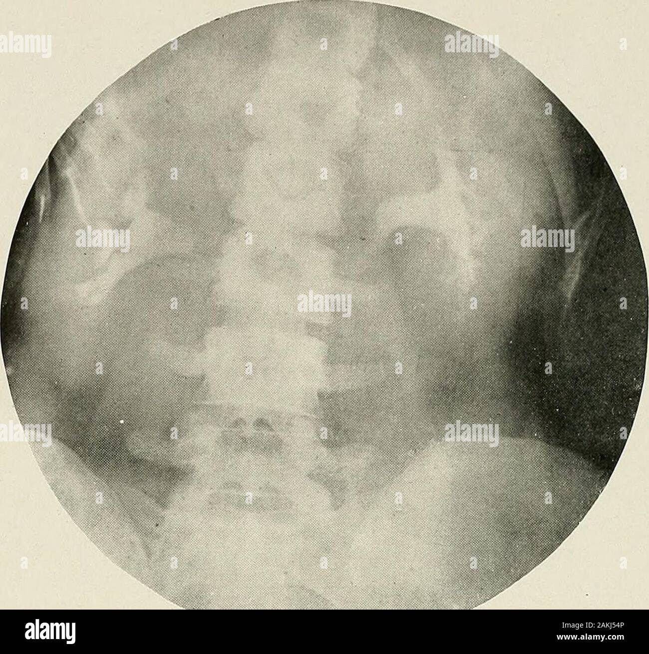 (Pyelo-ureterography La pyélographie) une étude de l'anatomie normale ...