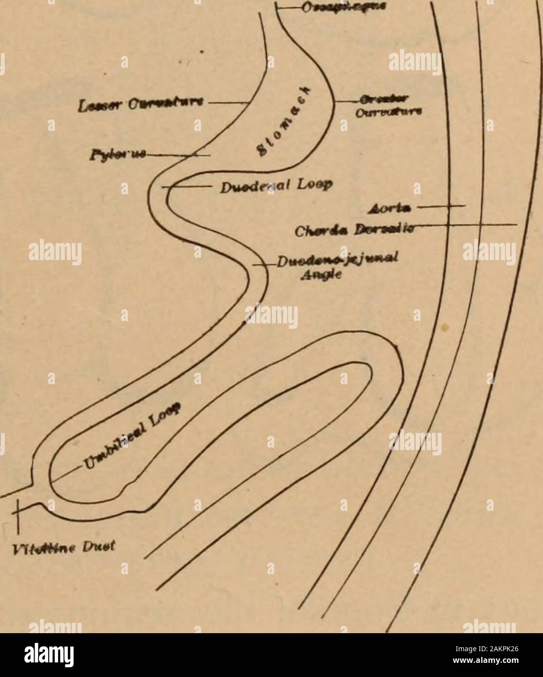 Diverticule sigmoïde Banque de photographies et d’images à haute ...
