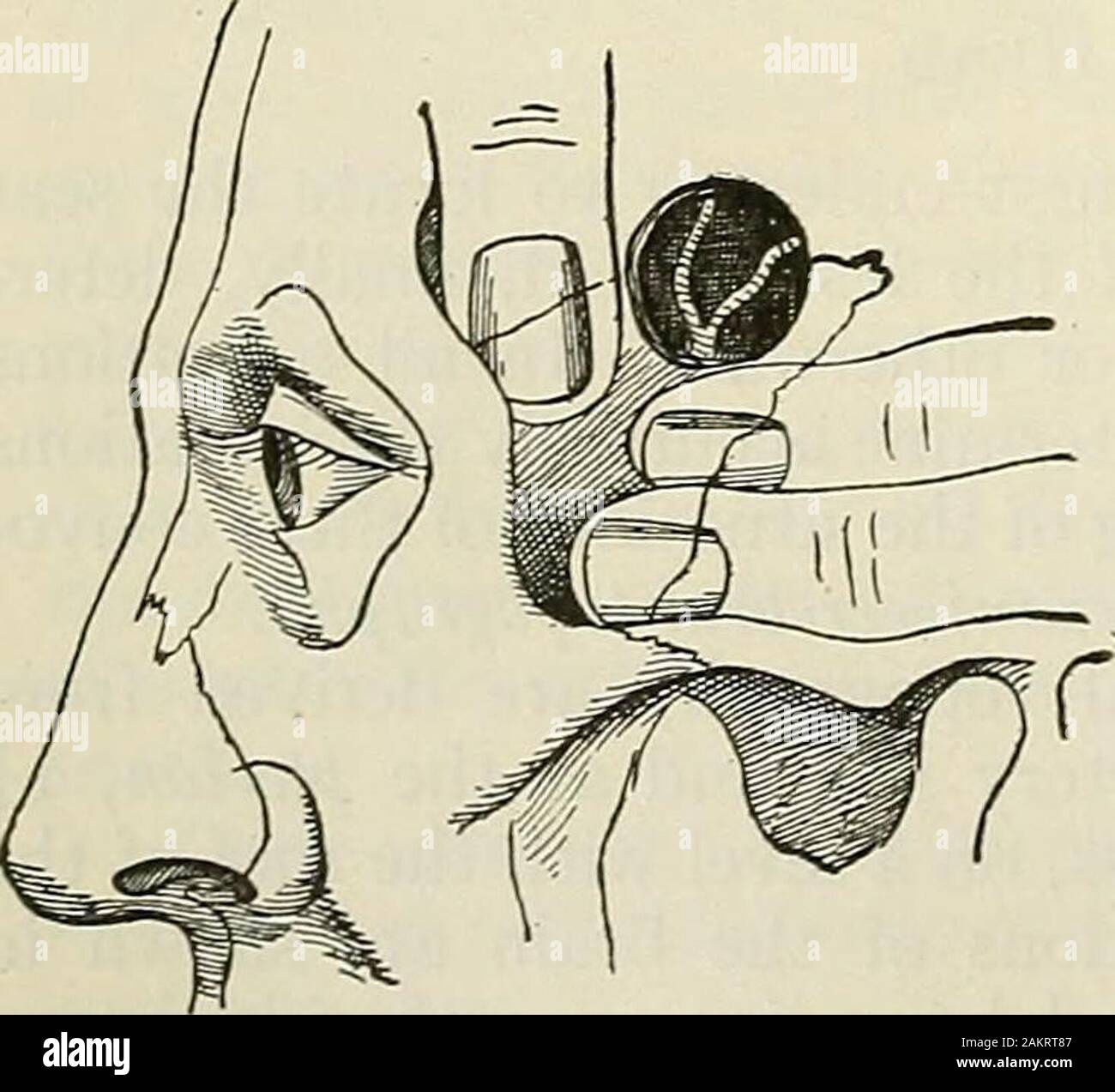 Squamous suture Banque de photographies et d’images à haute résolution ...