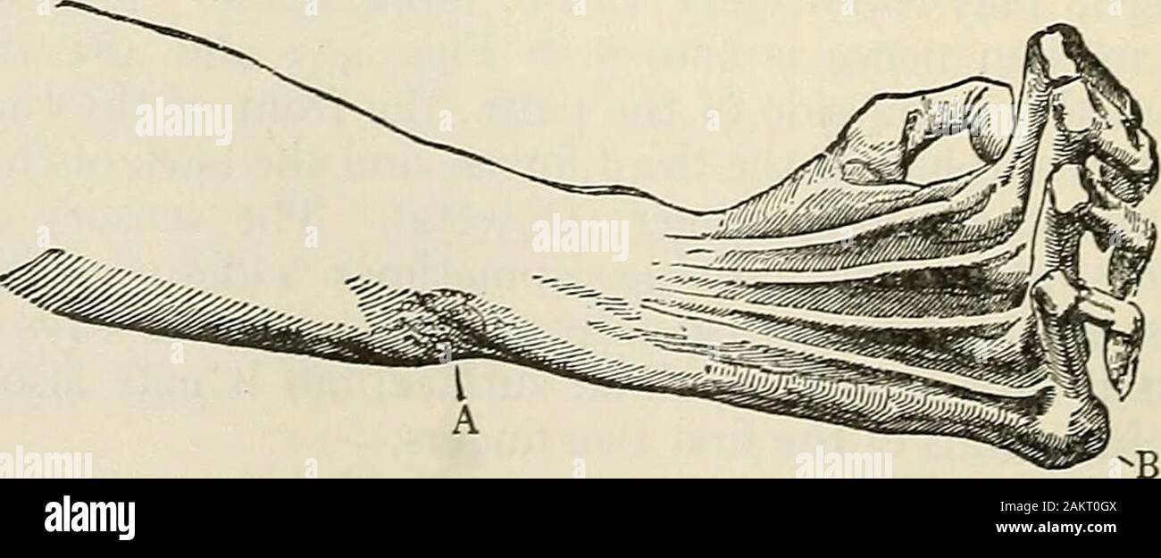 La chirurgie moderne, général et du dispositif . Fig. 488.-division du ...