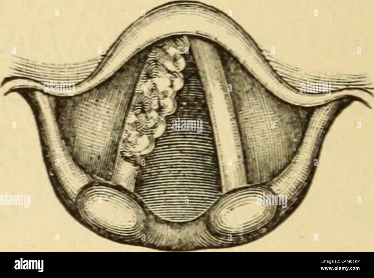 Papillome nez Banque de photographies et d’images à haute résolution ...