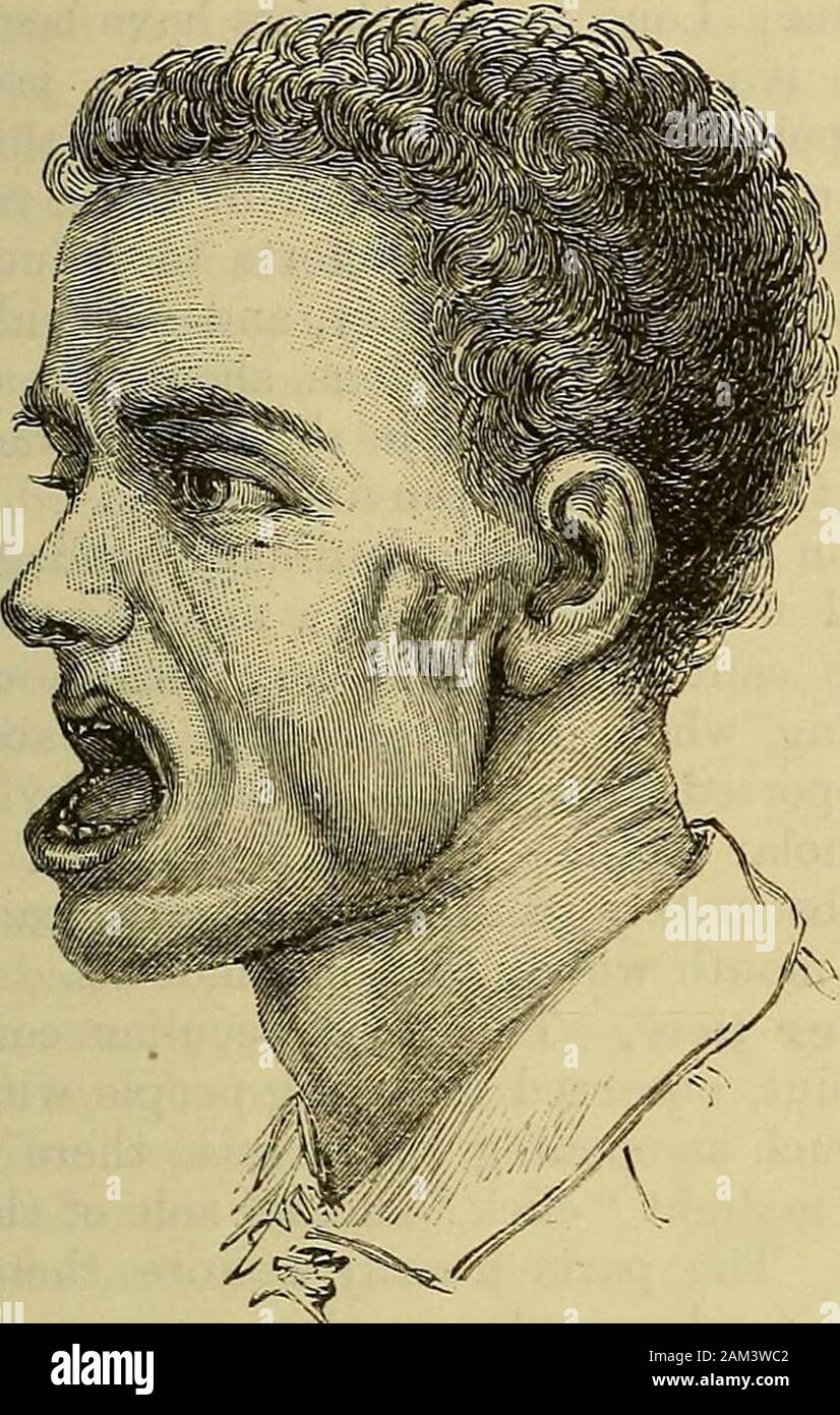 Un système de chirurgie . Fig. 373.-La position des os de luxation de ...