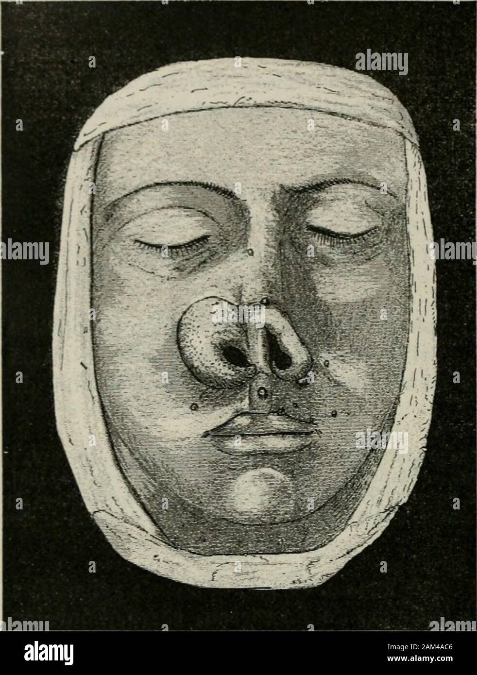 Syphilis chancre Banque de photographies et d’images à haute résolution ...