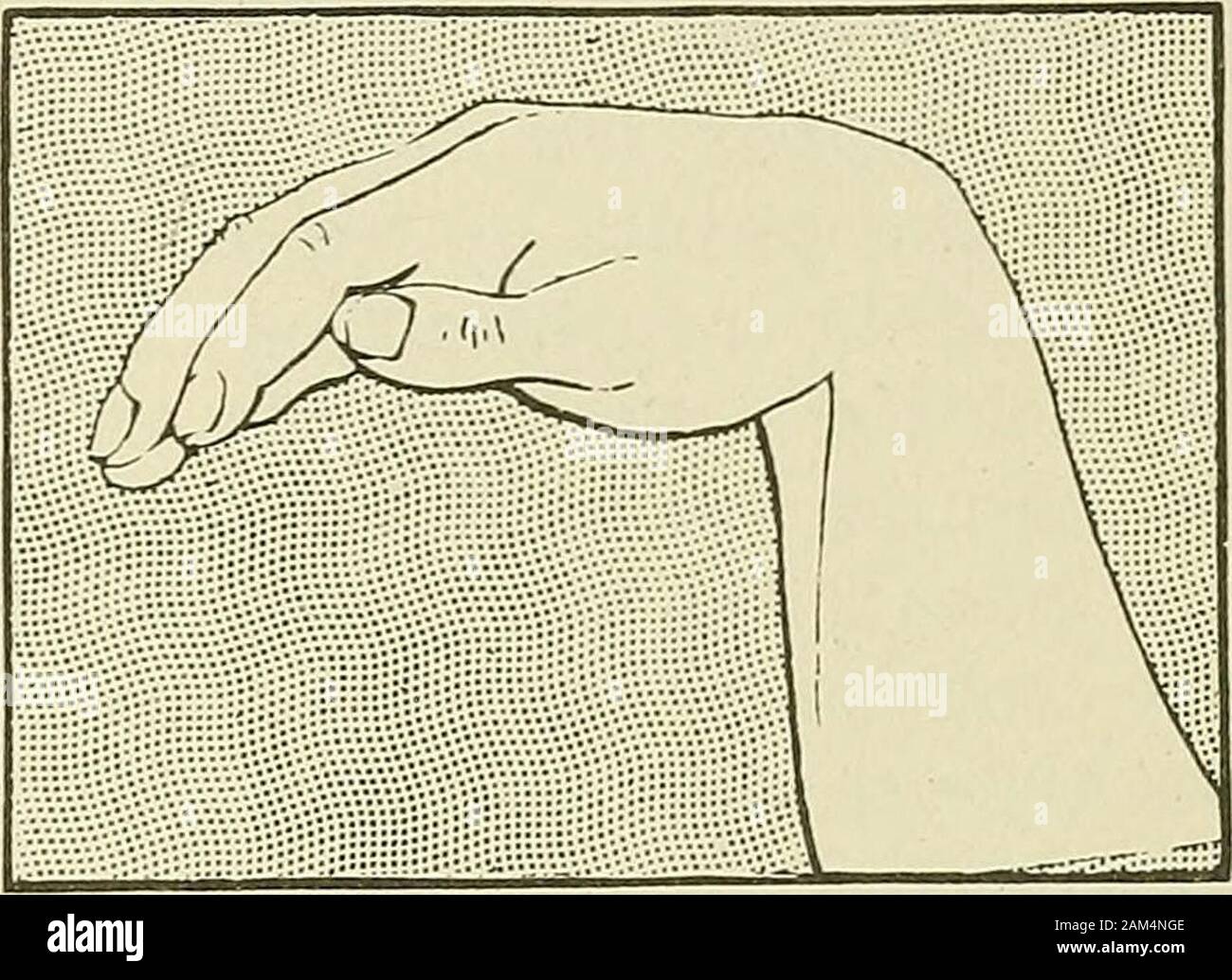 Tabatière anatomique Banque de photographies et d’images à haute ...