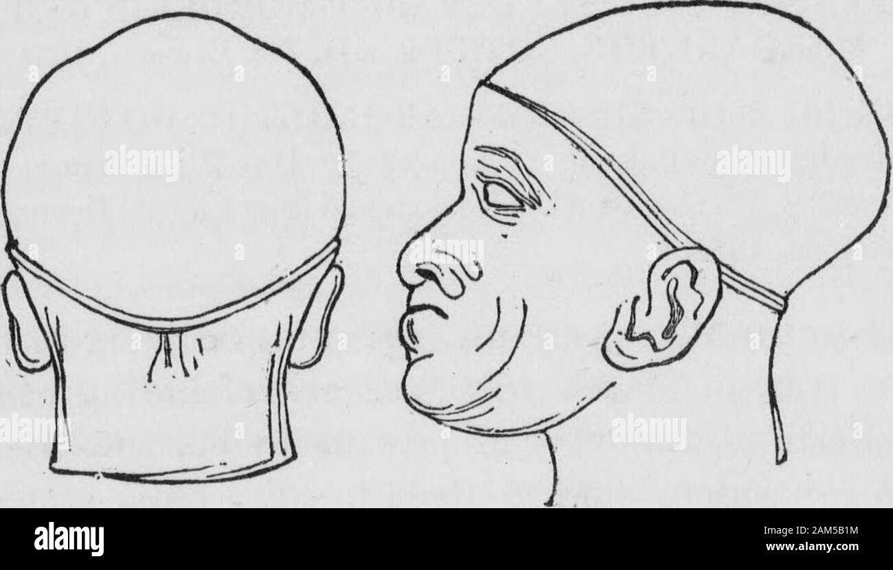 Une tête phrénologique Banque de photographies et d’images à haute ...