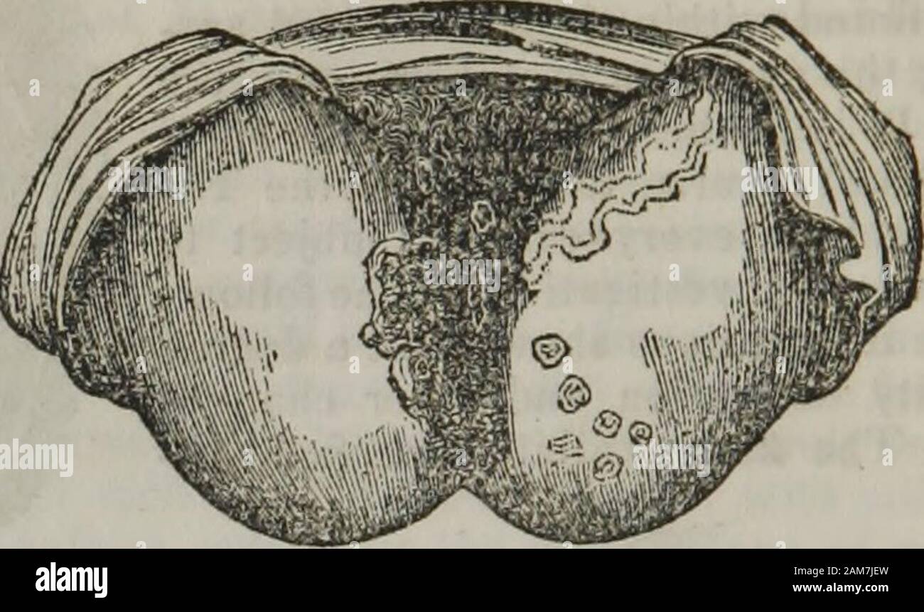 Porneiopathology : un traité sur les maladies vénériennes et d'autres ...