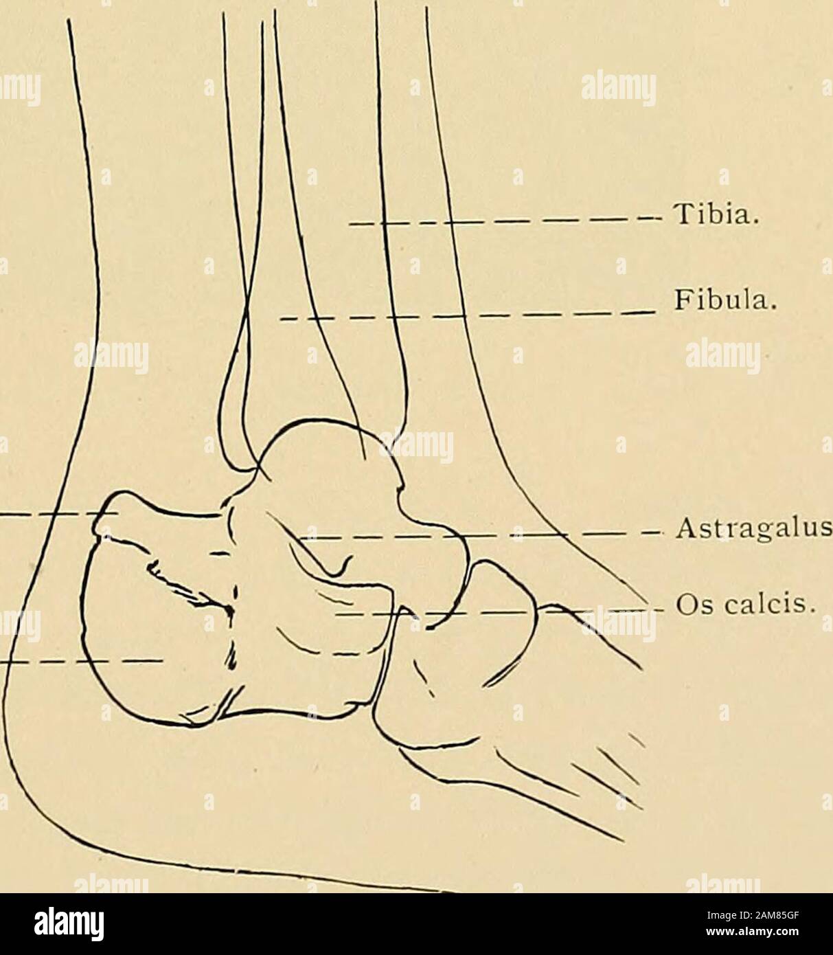 Malléole fracture externe Banque de photographies et d’images à haute ...