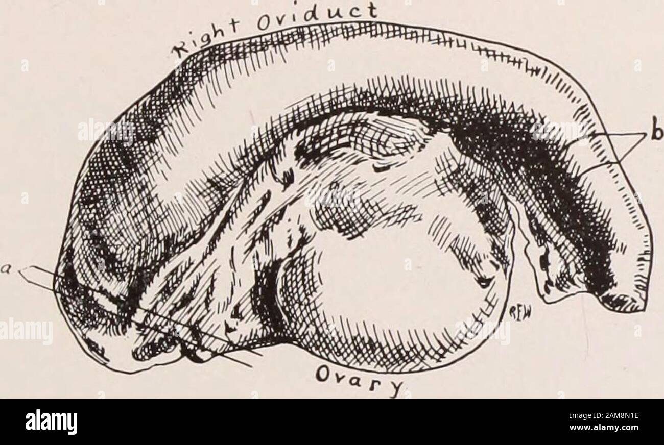 Appendix vermiformis Banque de photographies et d’images à haute ...