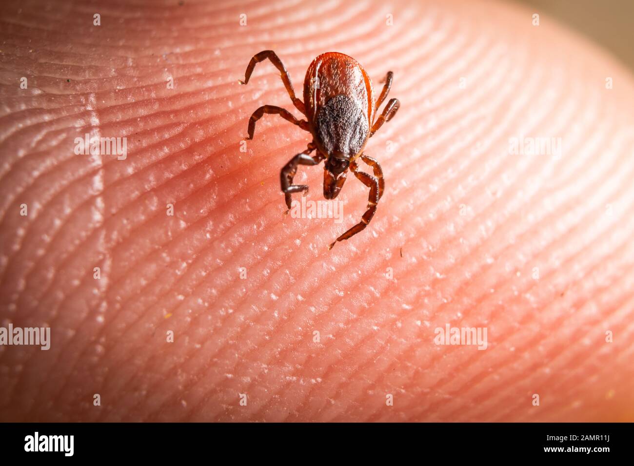 Tique Humain Banque d'image et photos - Alamy