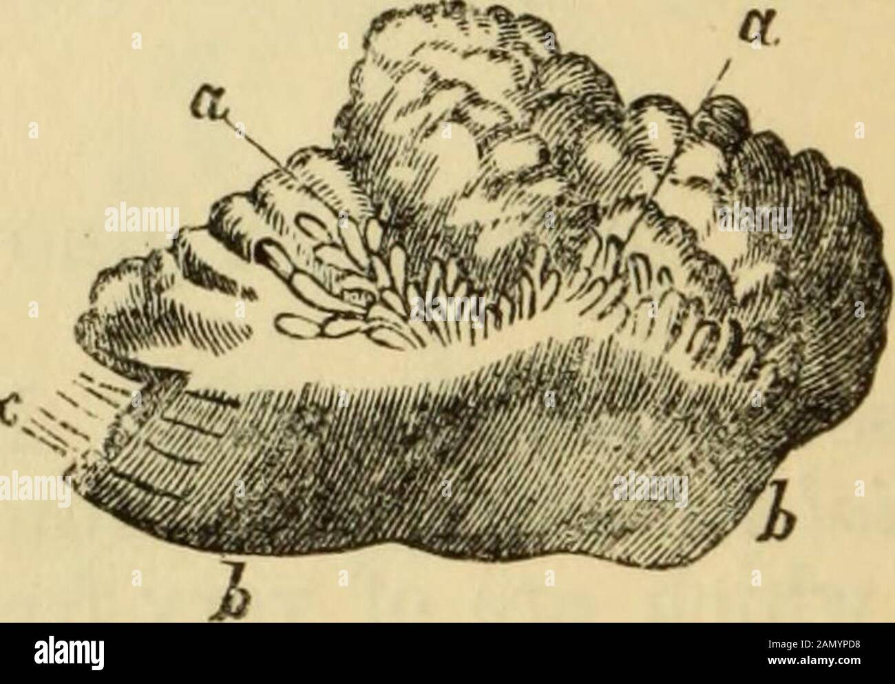 Manuel de l'anatomie pathologique . (A) proéminence Papillaire de la ...