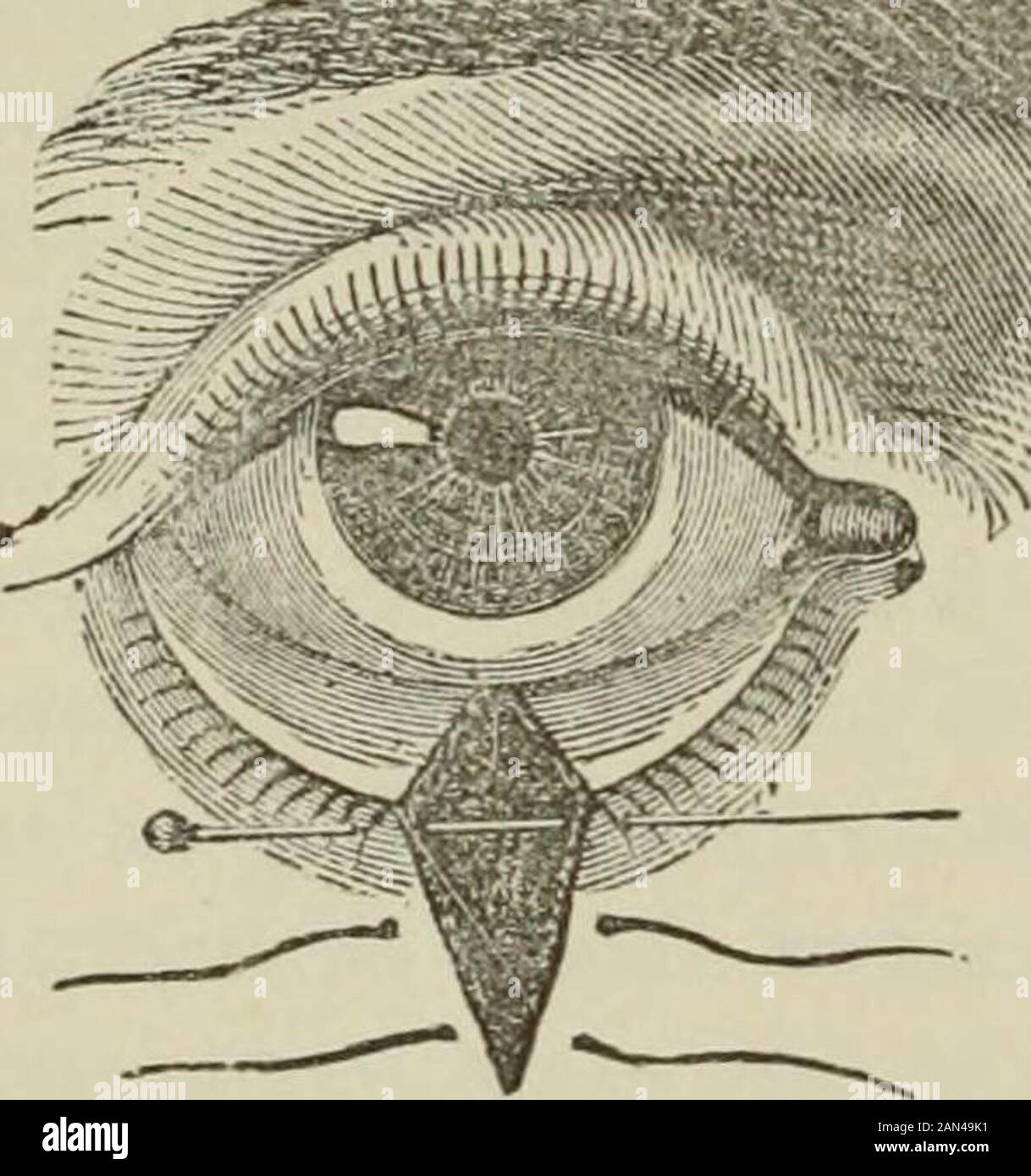 Conjunctival sac Banque de photographies et d’images à haute résolution ...