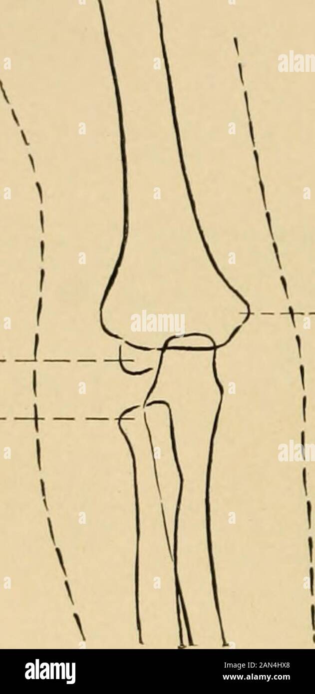 Condyle interne Banque de photographies et d’images à haute résolution ...