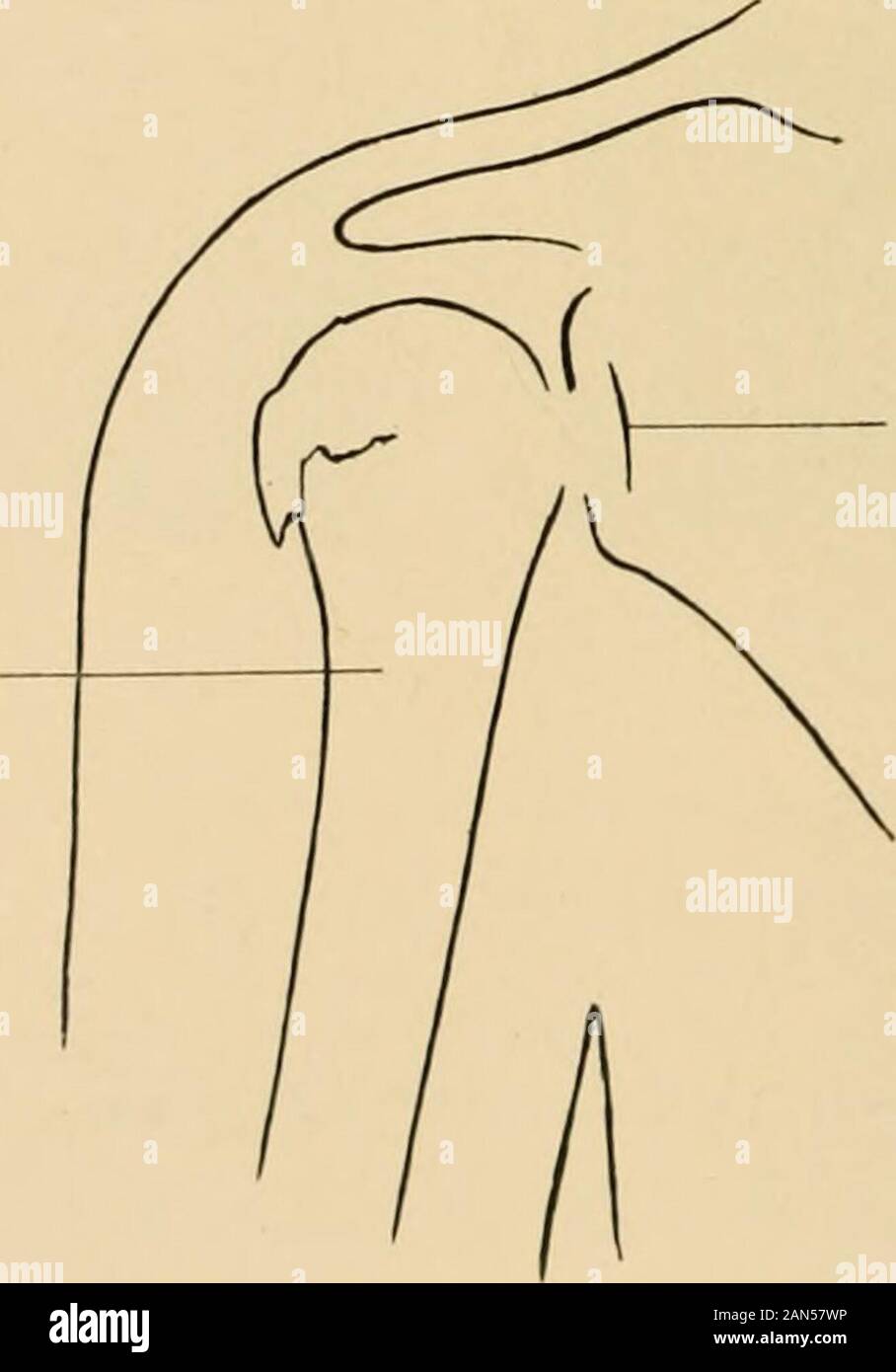 Le traitement des fractures . I-L'arbre du 1 nimei nous. Fig. 149 ...