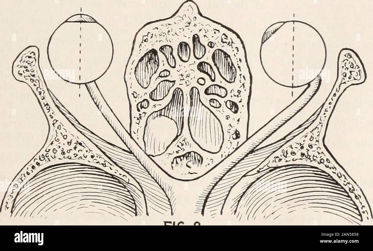 Tenon head Banque de photographies et d’images à haute résolution - Alamy
