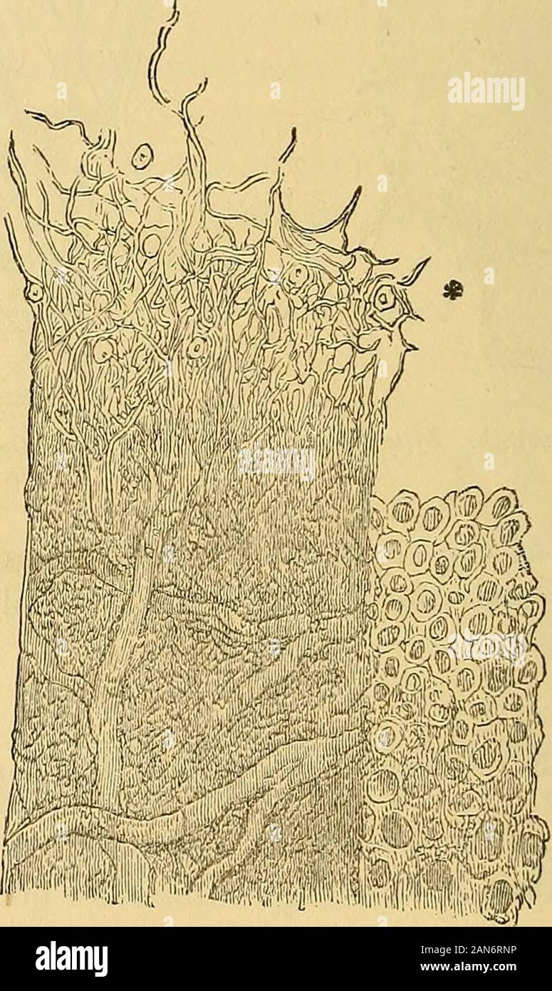 Un traité pratique sur les maladies de l'oreille y compris l'anatomie ...