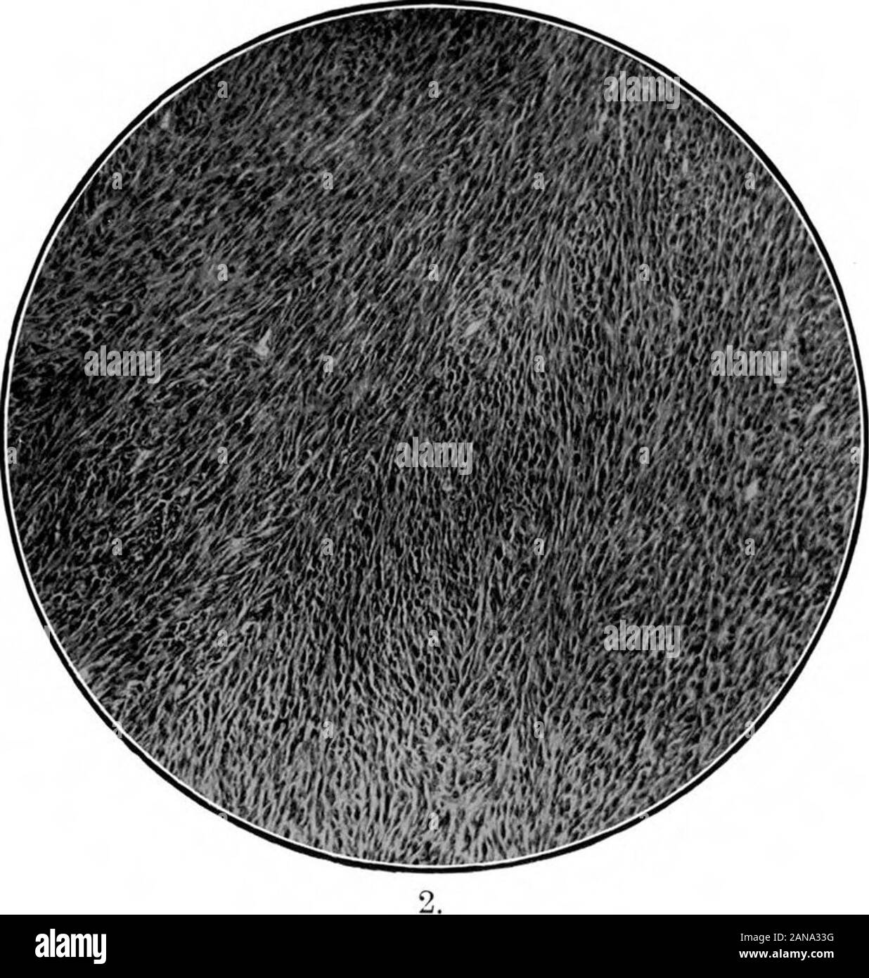 Sur l'action des rayons du radium sur les cellules de rat Sarcoma ...