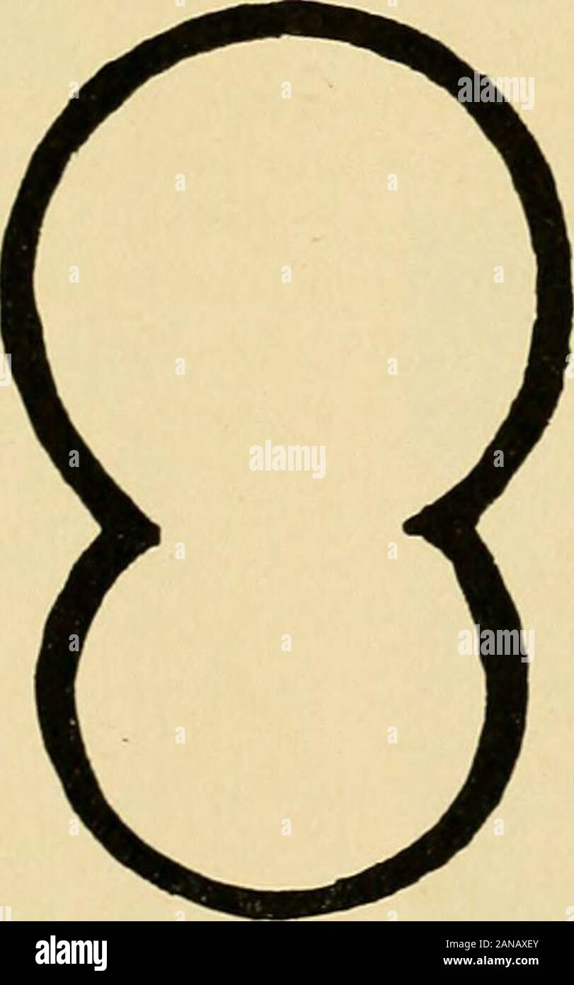 La morphologie du cloaque dans sa relation avec et génito-urinaires ...