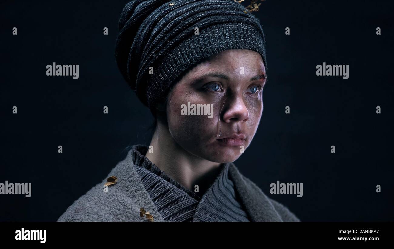 Visage bouffi Banque de photographies et d’images à haute résolution ...