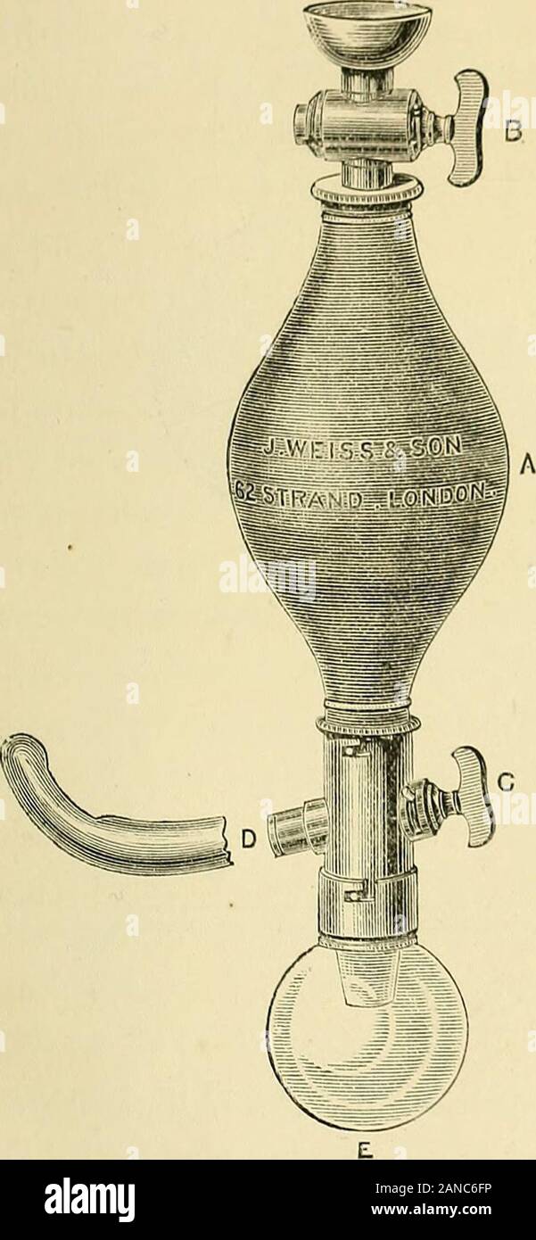 Le traitement moderne de la pierre dans la vessie par litholapaxy : une ...