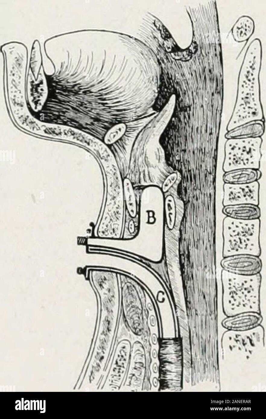 Troubles bronchiques Banque de photographies et d’images à haute ...