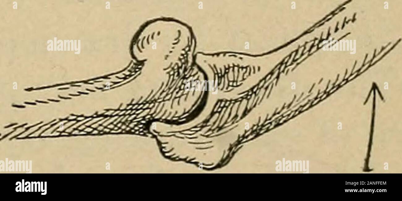 Condyle interne Banque de photographies et d’images à haute résolution ...