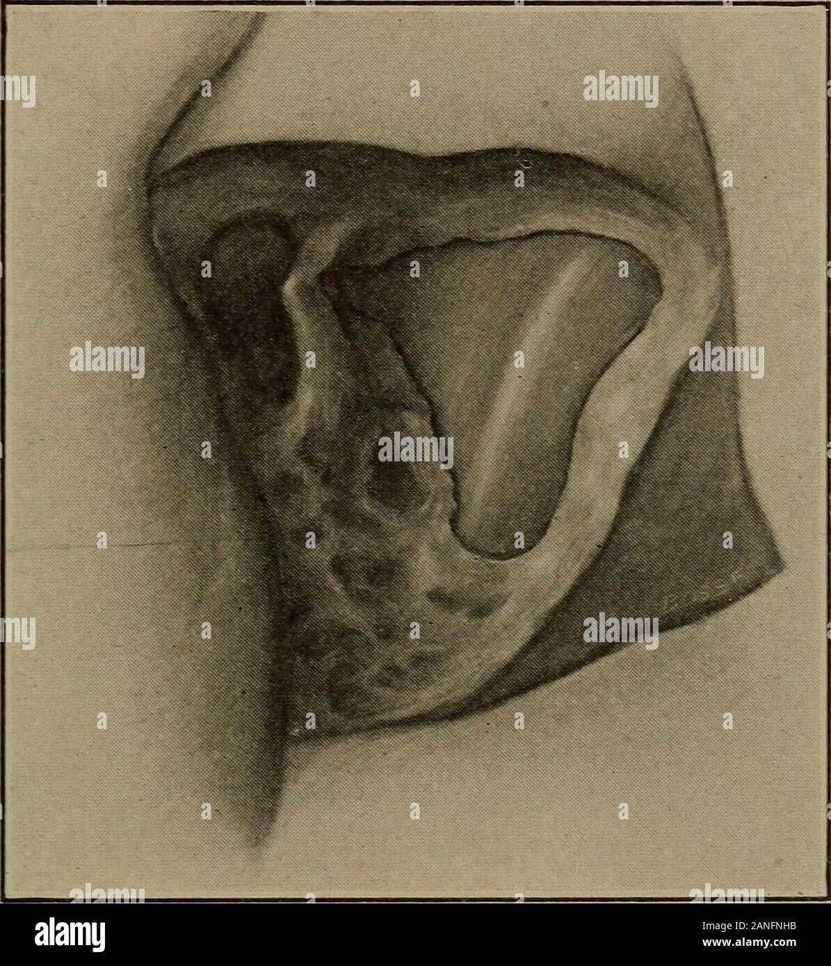 Diu triangulaire Banque de photographies et d’images à haute résolution ...