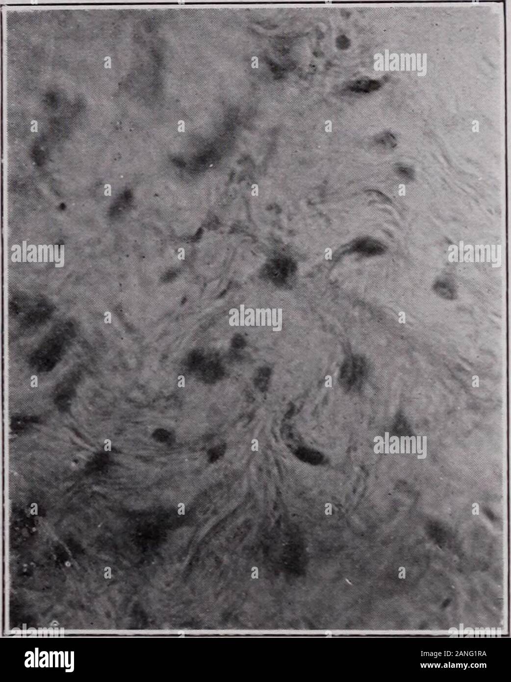 Loose connective tissue Banque de photographies et d’images à haute ...