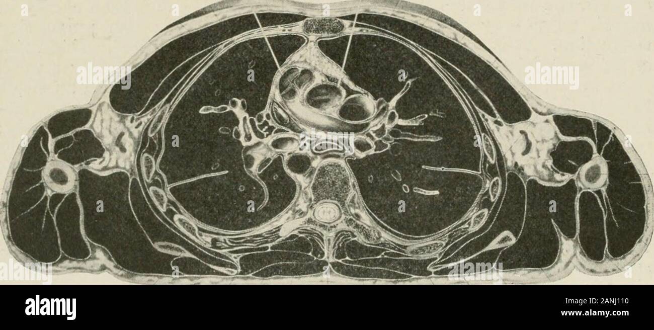 Les maladies de la poitrine et les principes de diagnostic physique ...