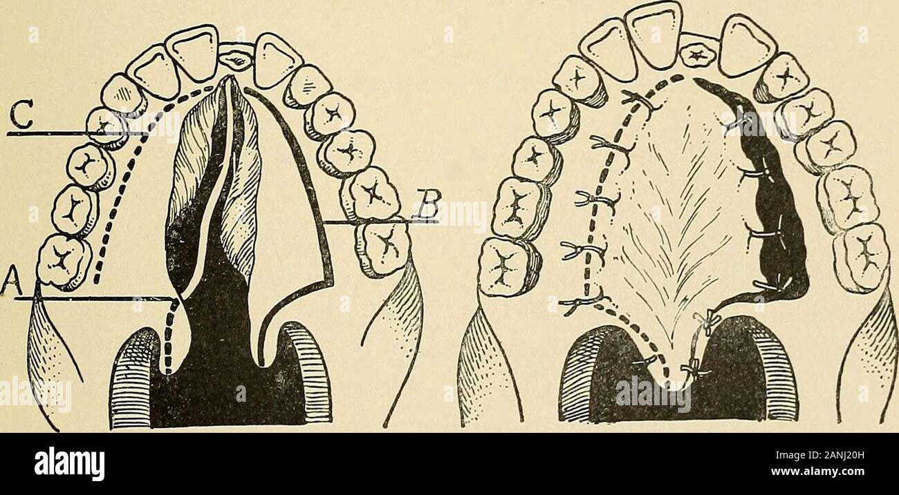 Os palatin Banque de photographies et d’images à haute résolution - Alamy