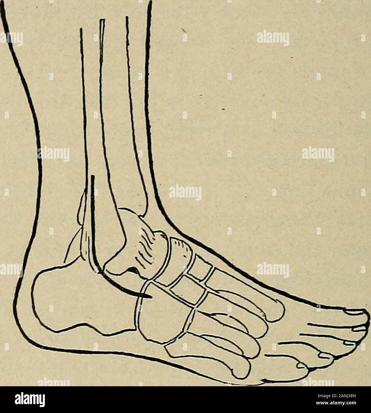 Extremidad dislocada Banque de photographies et d’images à haute ...