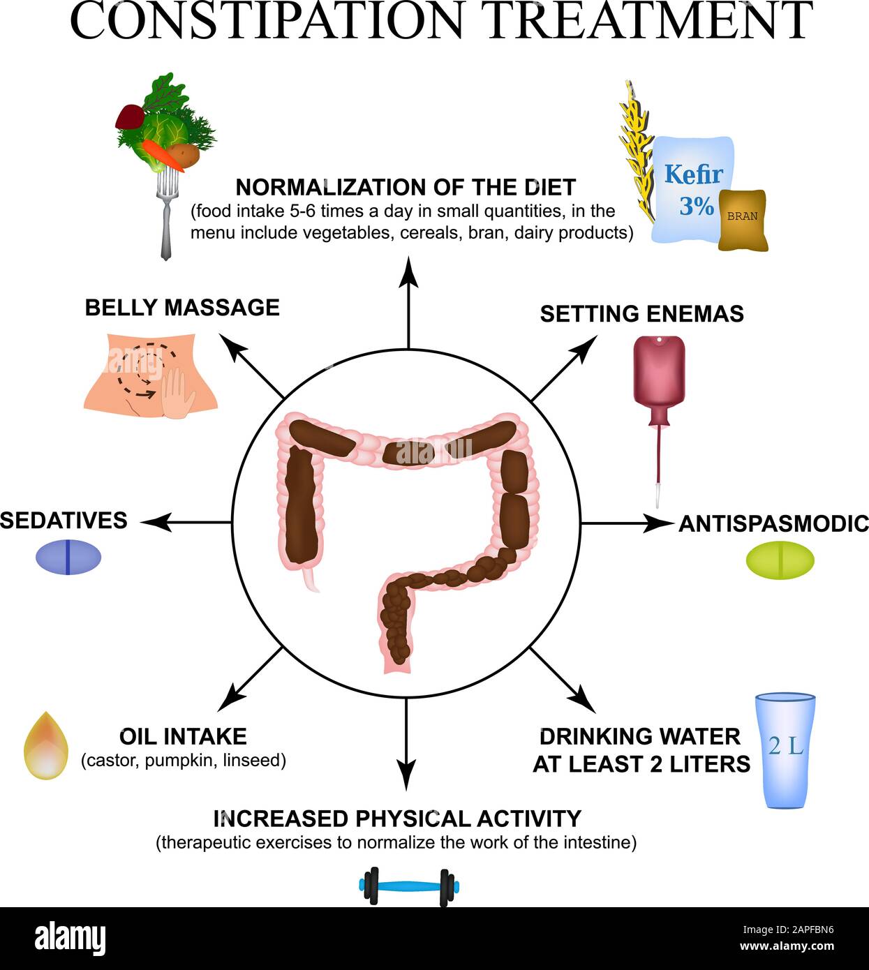 Traitement de la constipation. Infographies. Illustration vectorielle ...