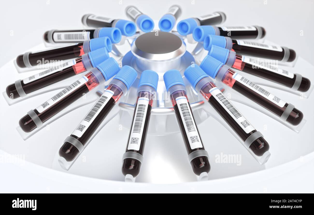 Test des tubes Banque de photographies et d’images à haute résolution ...